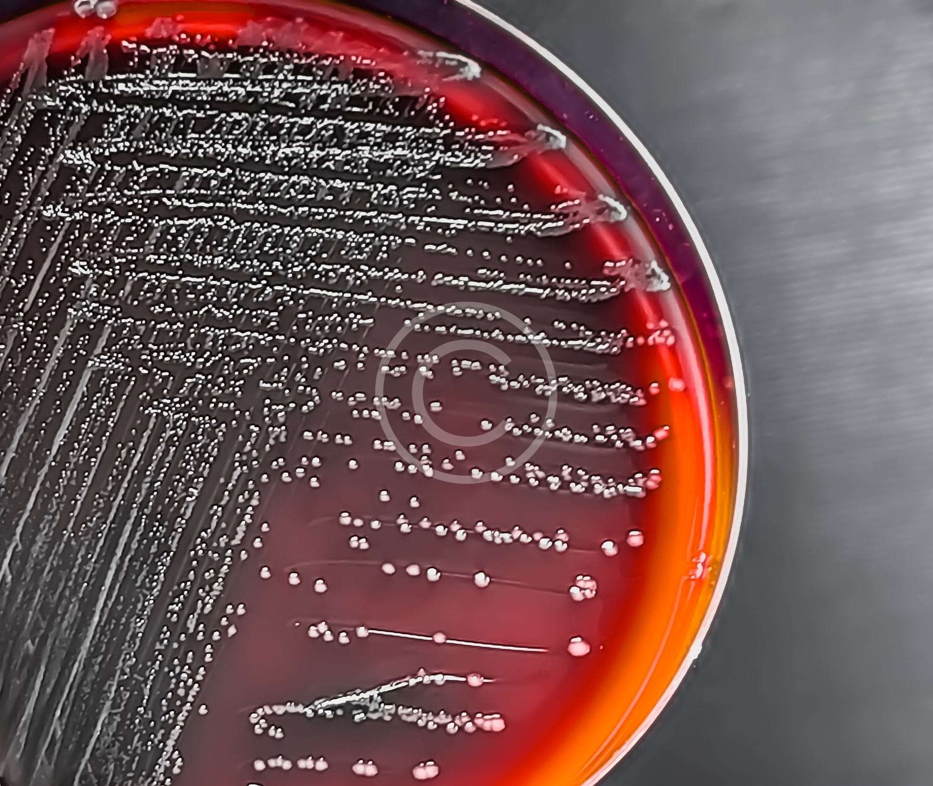 Kidney function test – Starpharma